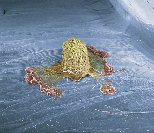 Macrophage On A Titanium Plate Greeting Card by Science Photo Library