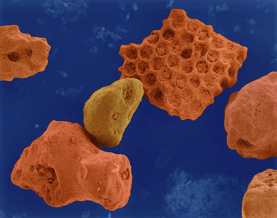 Coral Sand #1 by Dennis Kunkel Microscopy / Science Photo Library
