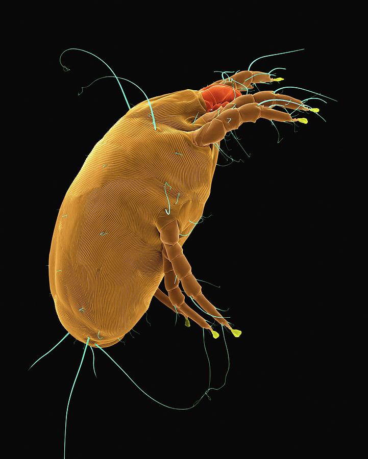 Dust Mite (dermatophagoides Pteronyssinus) #1 by Dennis Kunkel ...