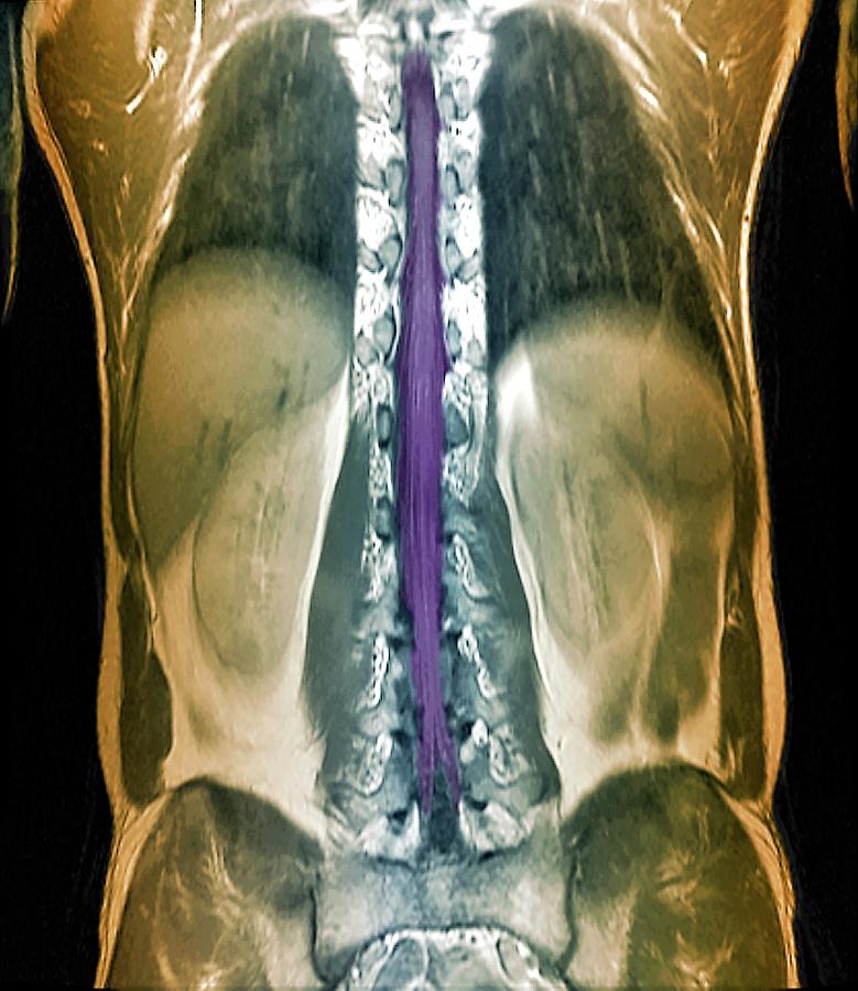 Normal Spinal Cord #1 by Zephyr / Science Photo Library