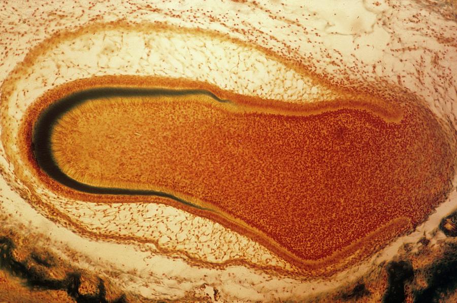 Tooth Bud #1 by Cnri / Science Photo Library