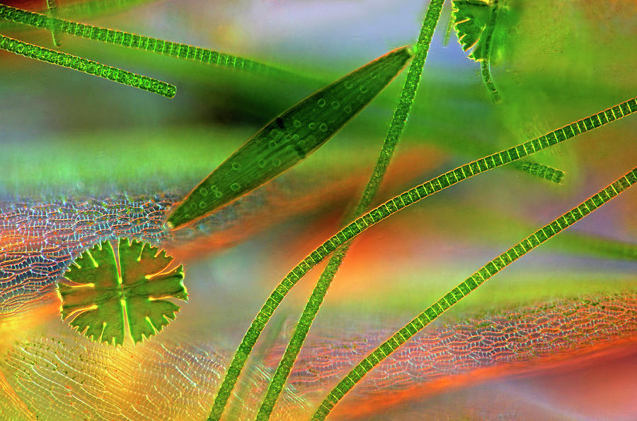 Desmids On Sphagnum Moss #12 by Marek Mis / Science Photo Library
