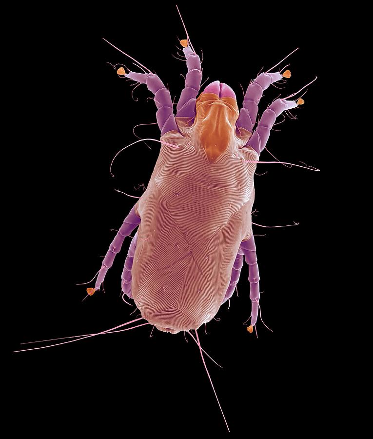 Dust Mite #13 by Dennis Kunkel Microscopy / Science Photo Library