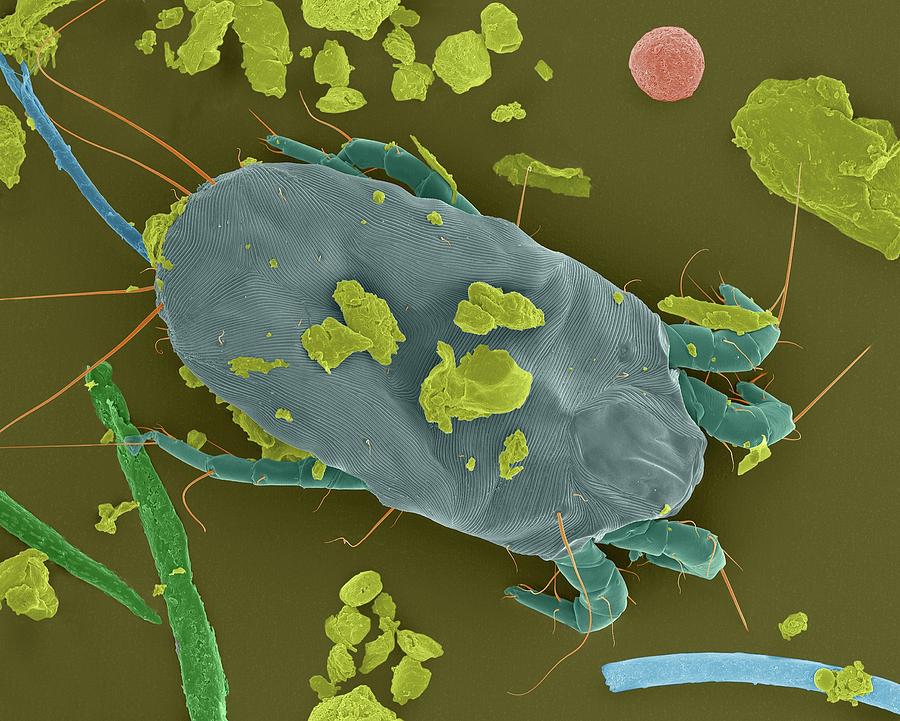 Dust Mite #17 by Dennis Kunkel Microscopy / Science Photo Library