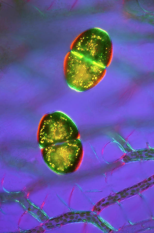 Desmids On Sphagnum Moss #18 by Marek Mis / Science Photo Library