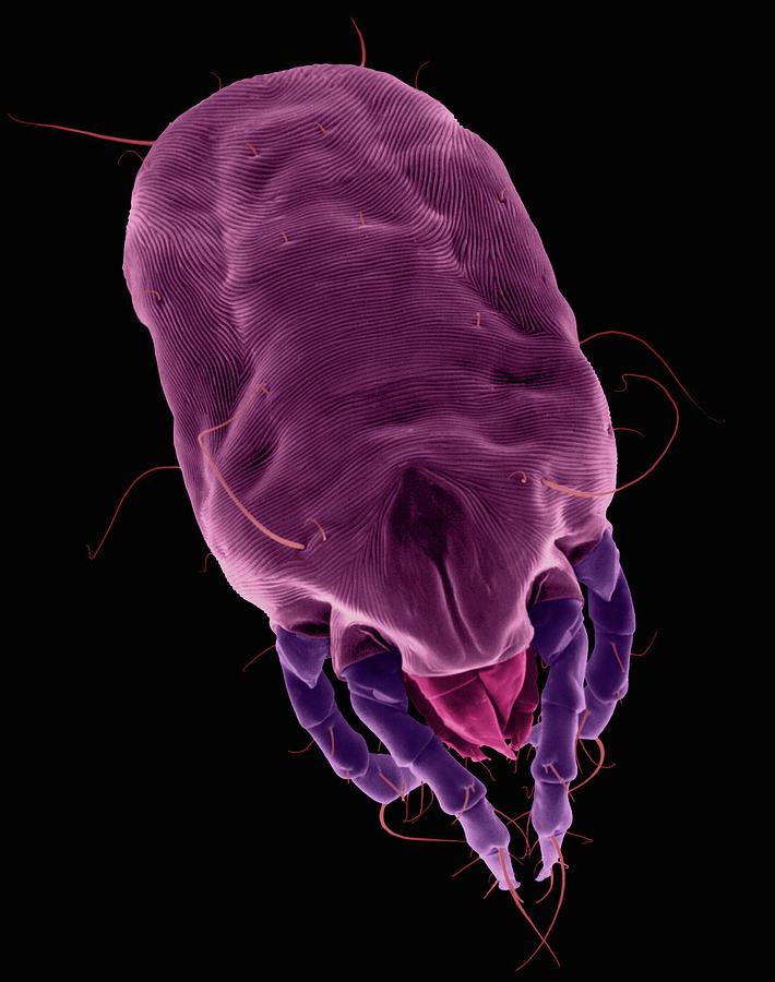 Dust Mite #18 by Dennis Kunkel Microscopy / Science Photo Library