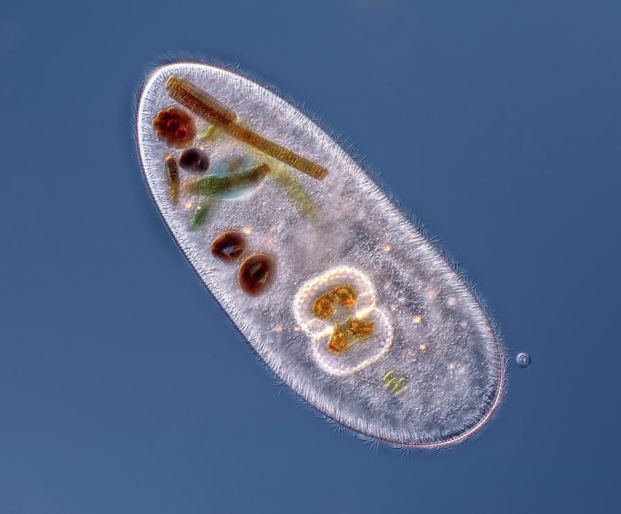 Frontonia Sp. Protist #2 by Rogelio Moreno / Science Photo Library