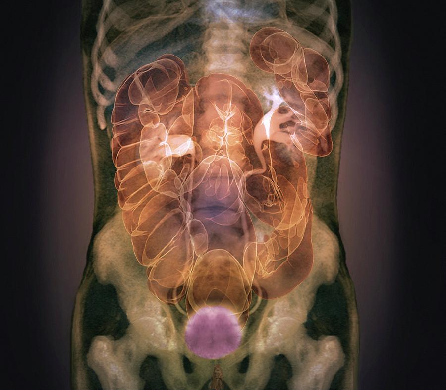 Healthy Abdomen #2 by Zephyr / Science Photo Library