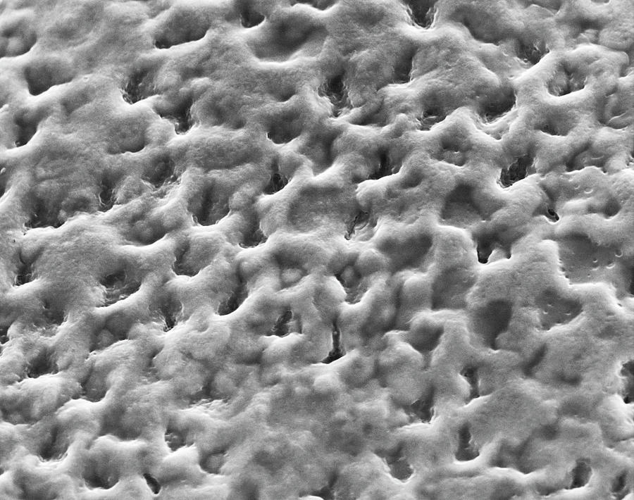Human Tooth Enamel Surface #2 by Dennis Kunkel Microscopy / Science ...