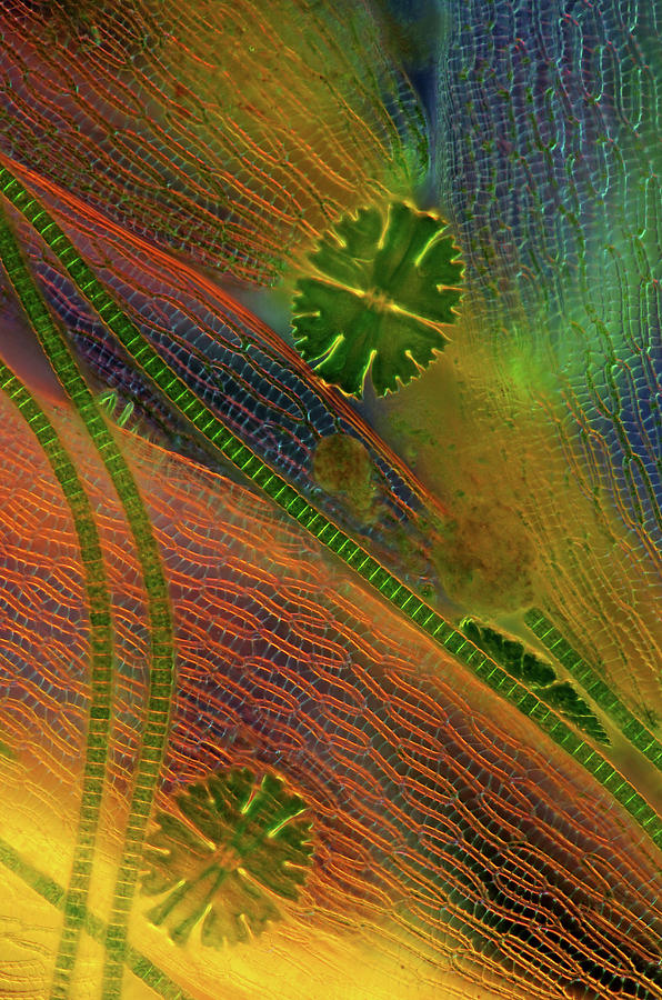 Desmids And Sphagnum Moss #3 by Marek Mis / Science Photo Library