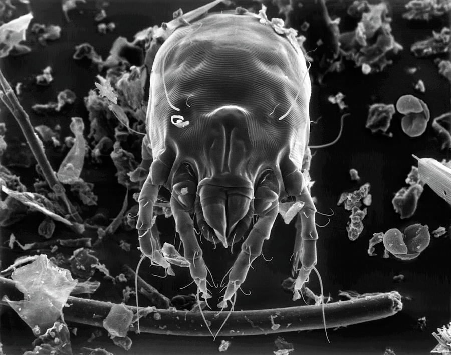 Dust Mite #3 by Dennis Kunkel Microscopy / Science Photo Library