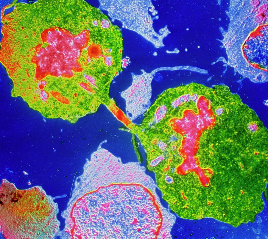 False-colour Tem Of Lymphocyte Undergoing Mitosis #3 by Cnri / Science ...