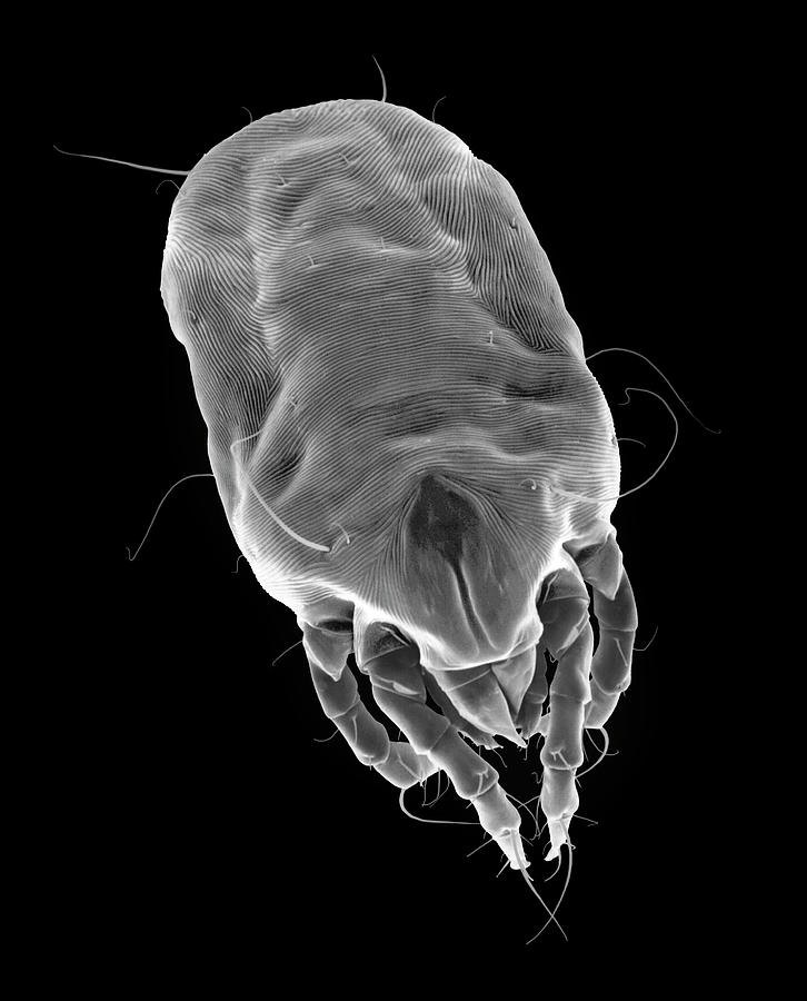 Dust Mite #30 by Dennis Kunkel Microscopy / Science Photo Library