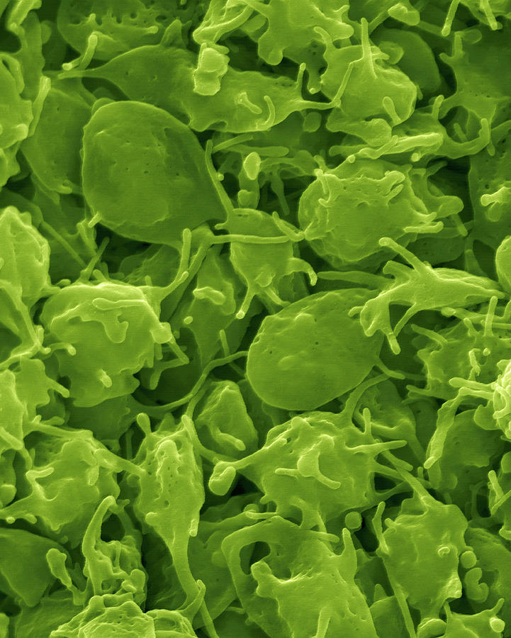 Activated Platelets #4 by Dennis Kunkel Microscopy / Science Photo Library