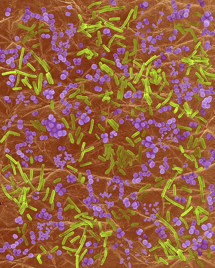 Bacteria On Human Skin #4 by Dennis Kunkel Microscopy / Science Photo ...