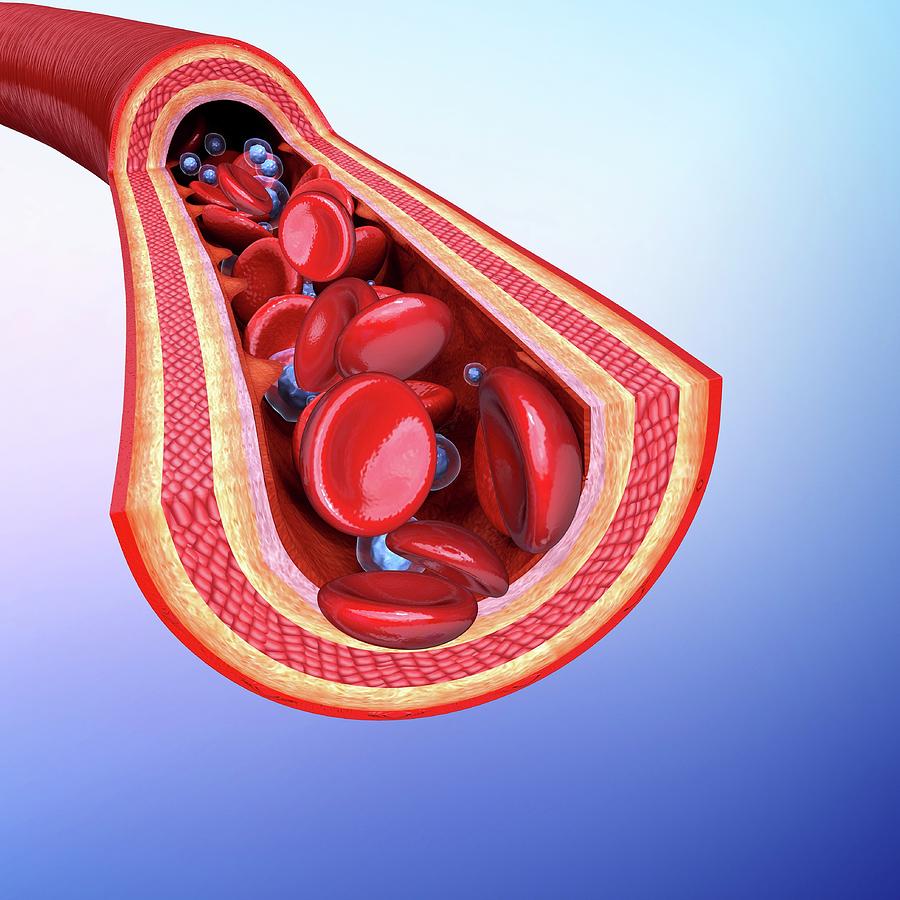 Human Artery #46 by Pixologicstudio / Science Photo Library
