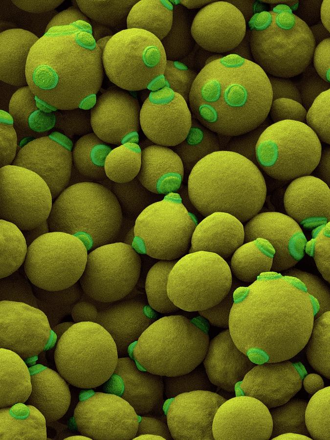 Candida Albicans Yeast Stage #5 by Dennis Kunkel Microscopy / Science ...