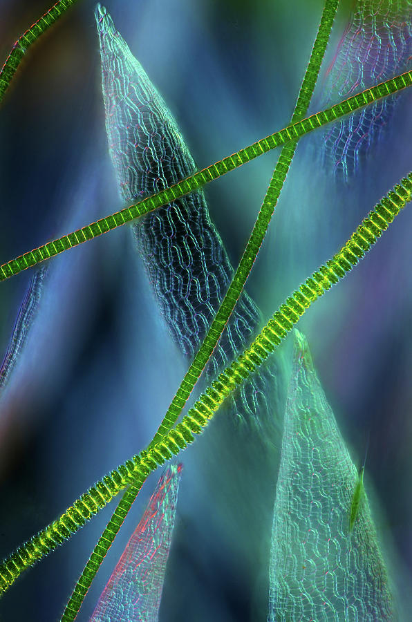 Desmids On Sphagnum Moss #5 by Marek Mis / Science Photo Library