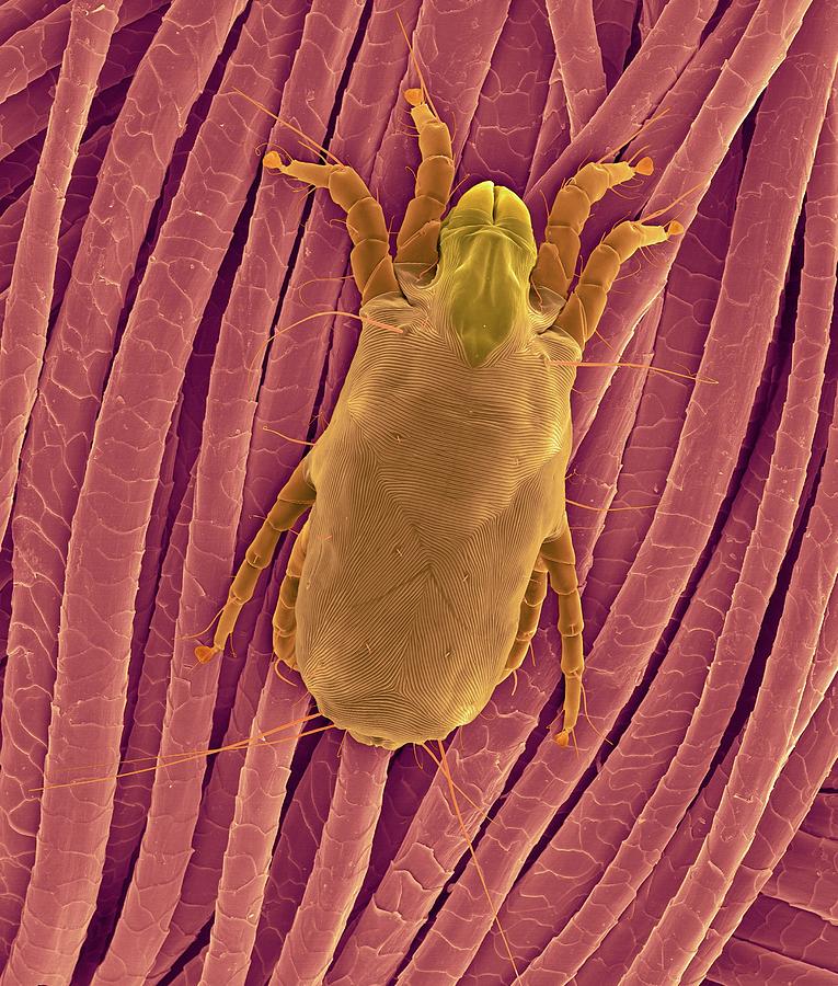 Dust Mite On Wool Fabric #6 by Dennis Kunkel Microscopy / Science Photo ...