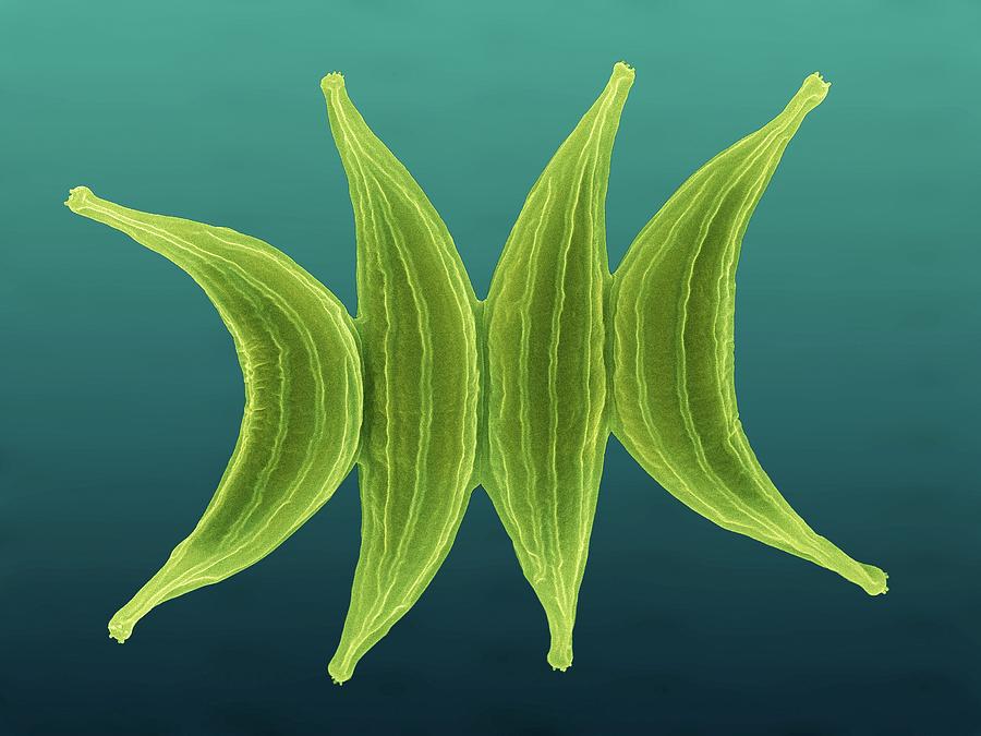 Scenedesmus Spp. #6 by Dennis Kunkel Microscopy / Science Photo Library