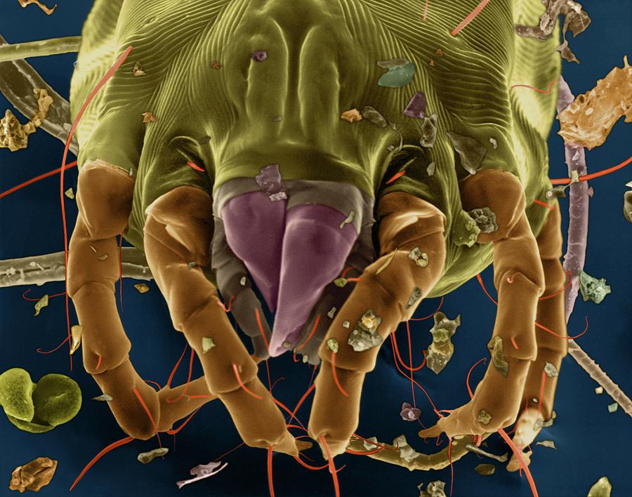 Dust Mite #7 by Dennis Kunkel Microscopy / Science Photo Library