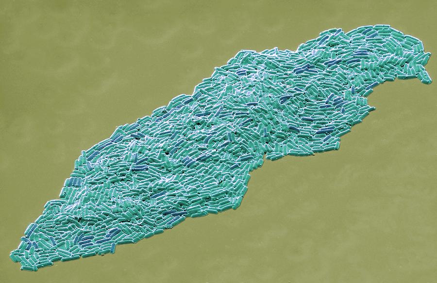 Bacillus Subtilis by Steve Gschmeissner / Science Photo Library