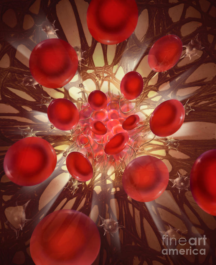 Blood Clot Breaking Up by Jim Dowdalls