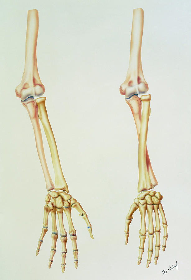 Bones Of The Arm In Pronation And Supination by "Bo Veisland, MiandI ...
