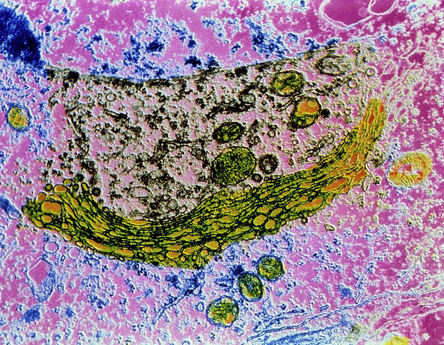 False-colour Tem Of A Golgi Apparatus by Cnri / Science Photo Library