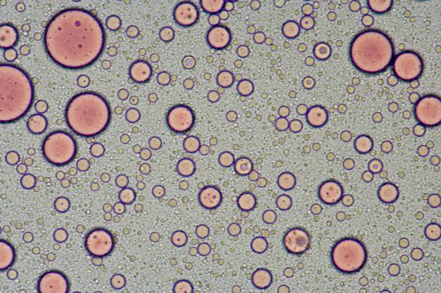 Fat Globules in Cow's Milk (LM) by Power And Syred / Science Photo Library