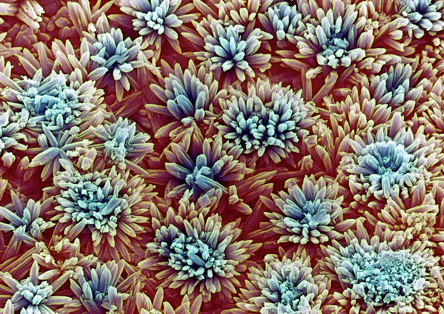 Limescale by Dr Jeremy Burgess / Science Photo Library