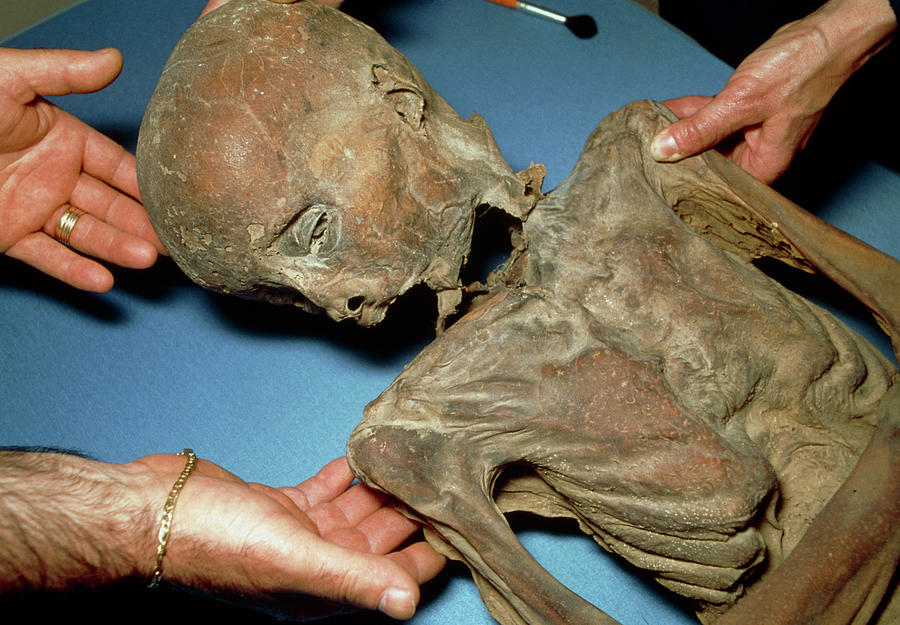 Mummified Body Of A Boy Dating From Around 1600 by Klaus Guldbrandsen ...