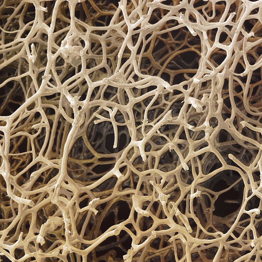 Natural Sponge, Sem by Power And Syred / Science Photo Library