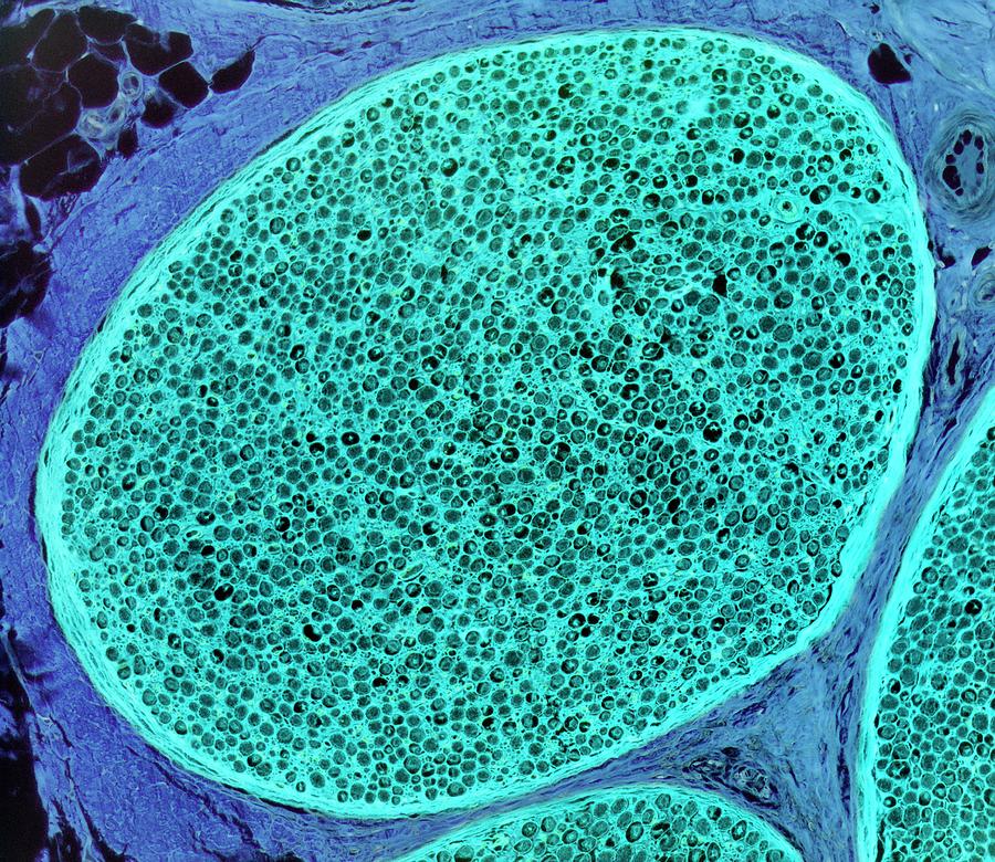 Nerve by Steve Gschmeissner / Science Photo Library
