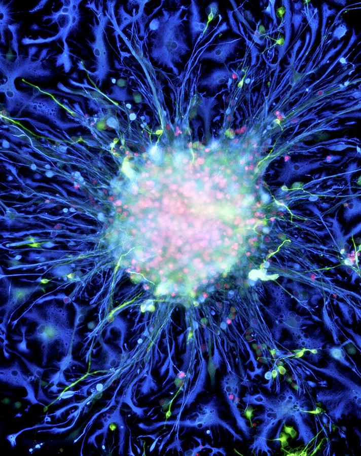 Neural Stem Cell Culture by Riccardo Cassiani-Ingoni / Science Photo ...