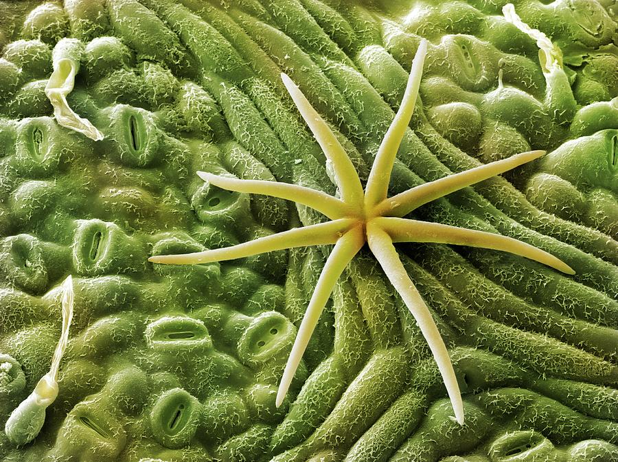 Oak Leaf Epidermis (quercus Robur) by Power And Syred / Science Photo ...