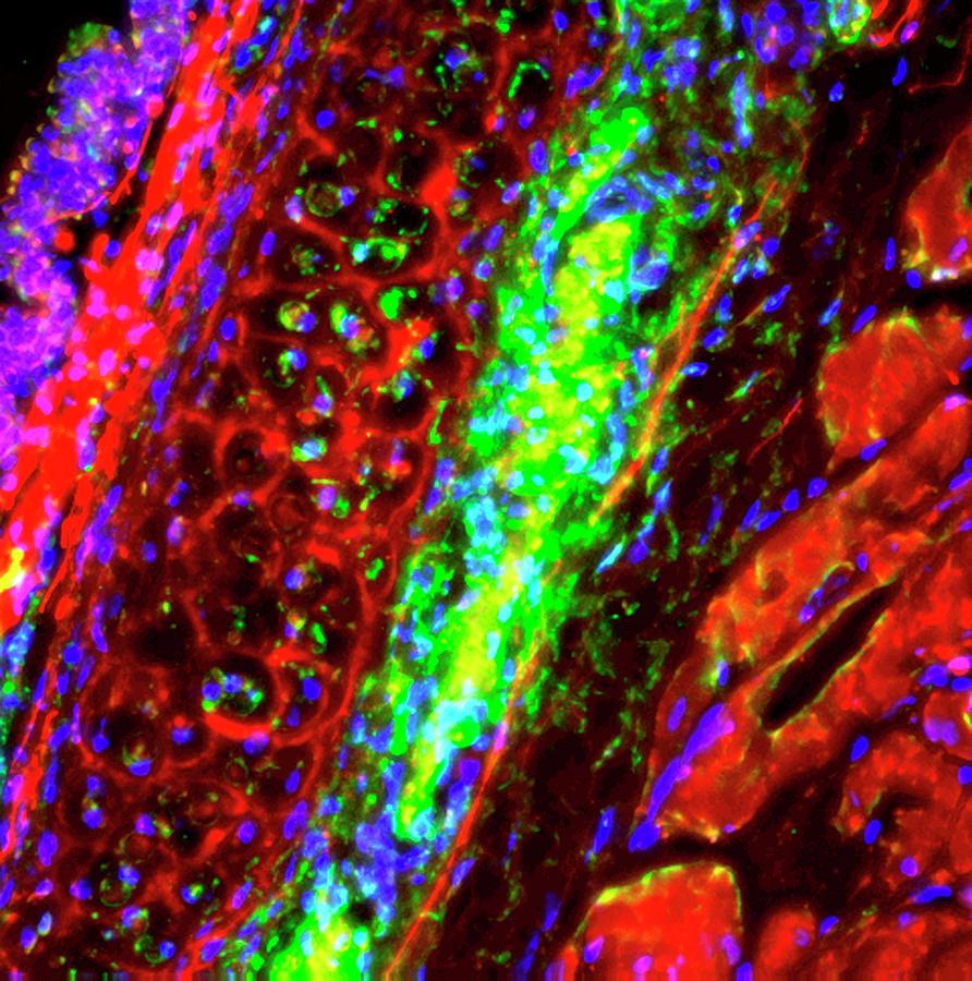 Rat Trachea by "R. Bick, B. Poindexter, Ut Medical School / Science ...