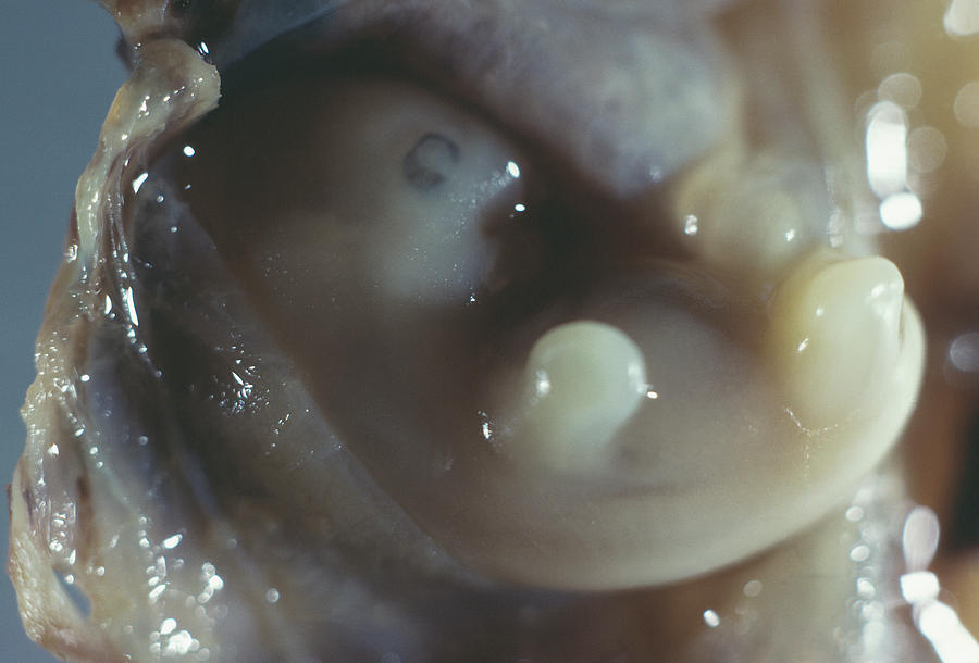 Six-week-old Embryo by Cnri / Science Photo Library