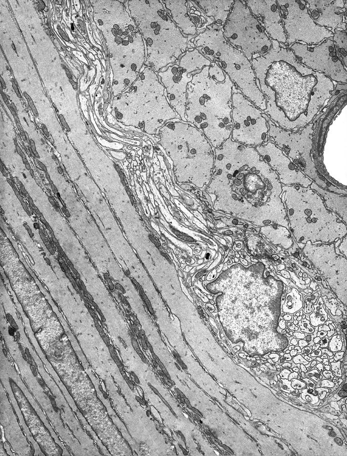 Smooth muscle of gut wall, TEM by Microscape / Science Photo Library