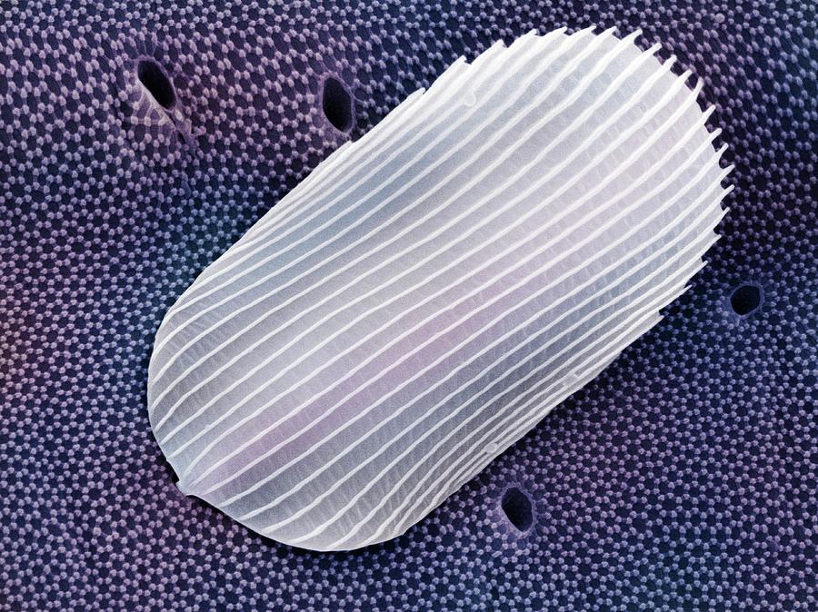Springtail Scale (order Collembola) by Power And Syred / Science Photo ...