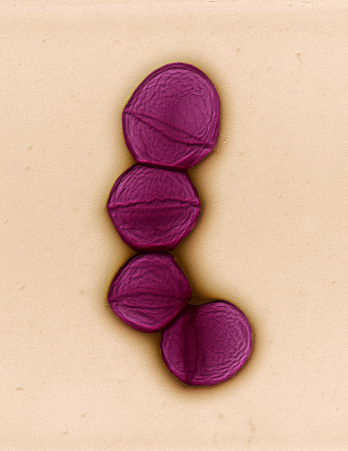 Streptococcus Agalactiae, Tem by Eye of Science