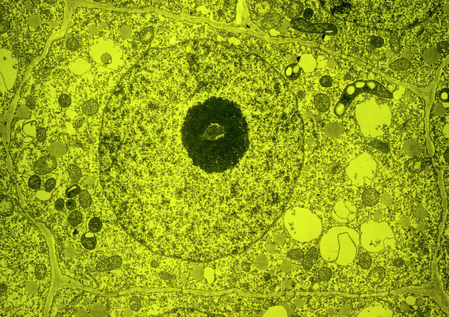 Tem Of Plant Cell From Root Tip Of Maize by Dr Jeremy Burgess / Science ...