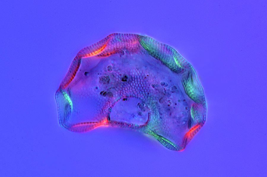 Testate Amoeba by Marek Mis / Science Photo Library