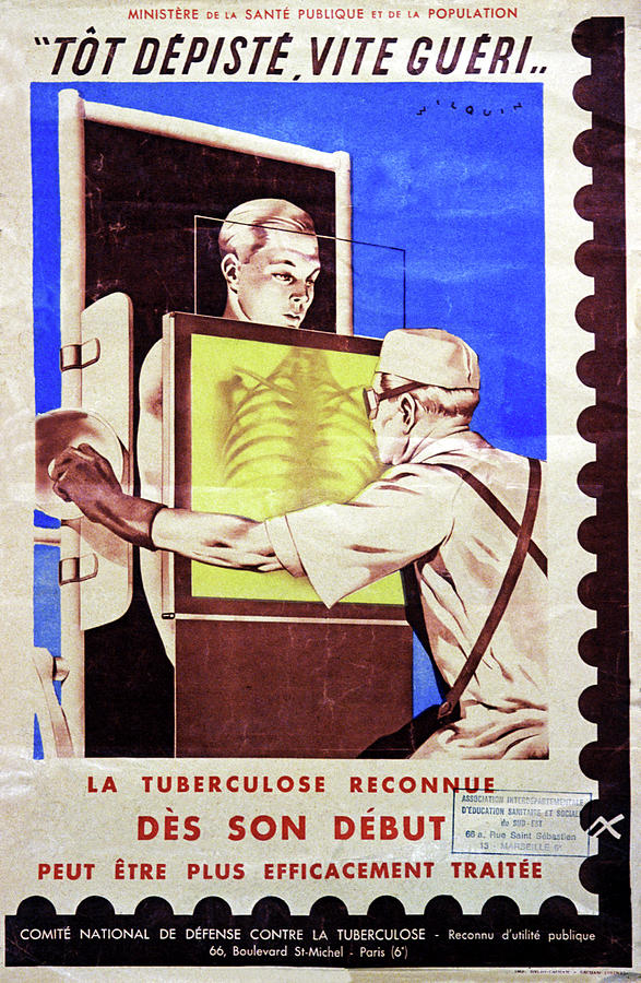 Tuberculosis Screening by Cci Archives / Science Photo Library