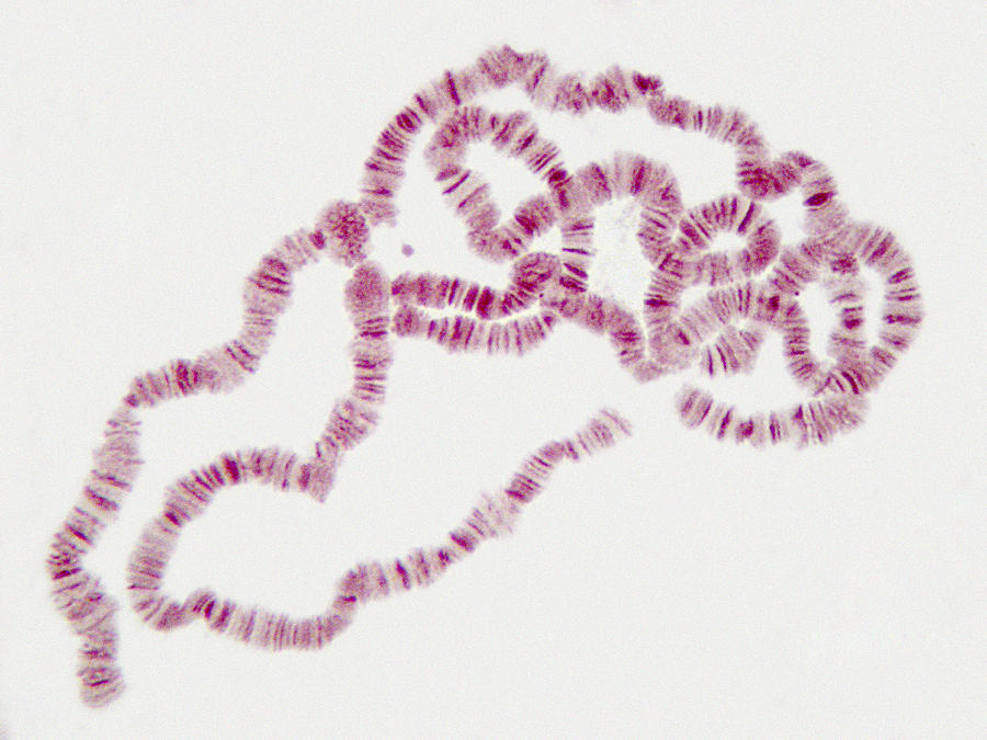 Giant Chromosomes, Light Micrograph #1 by Power And Syred / Science ...