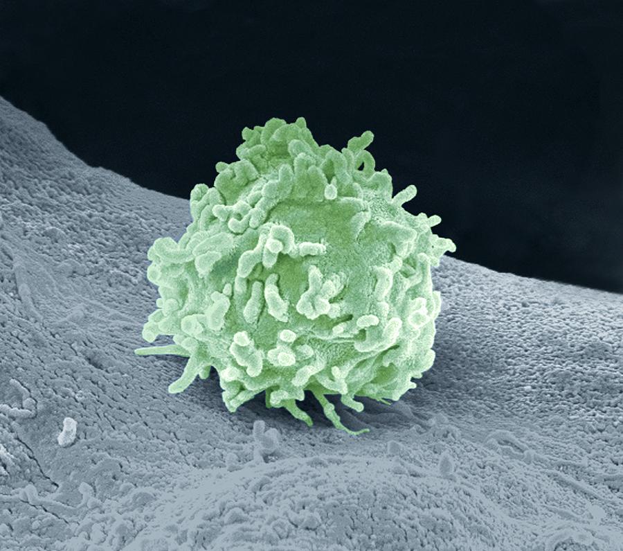 Granulocyte, Sem #1 by Steve Gschmeissner / Science Photo Library