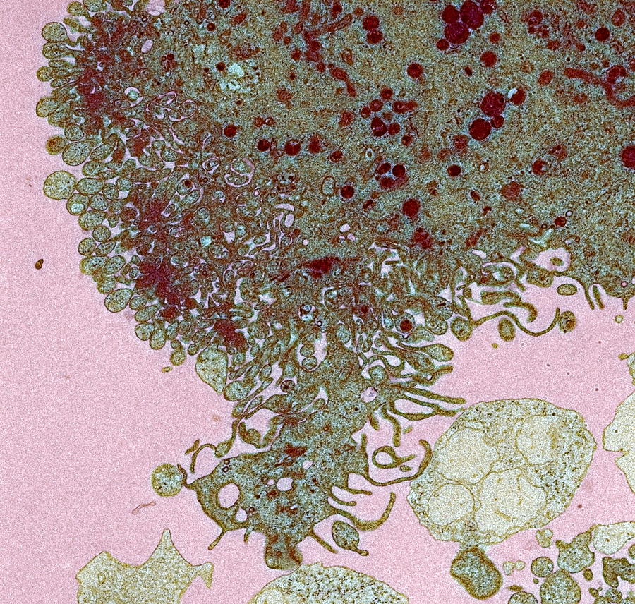 Leukaemia Cell, Tem #1 by Steve Gschmeissner / Science Photo Library