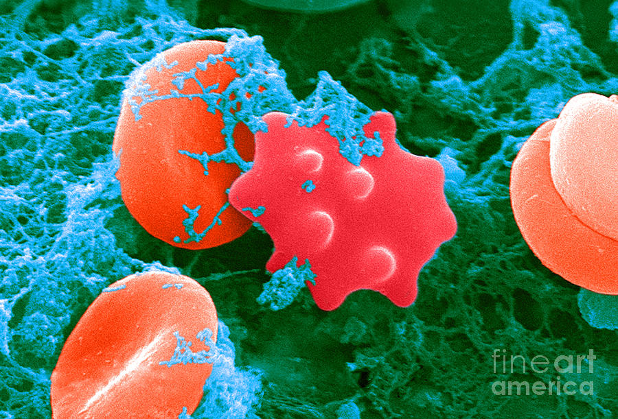 Red Blood Cells And Acanthocyte, Sem #1 by Science Source