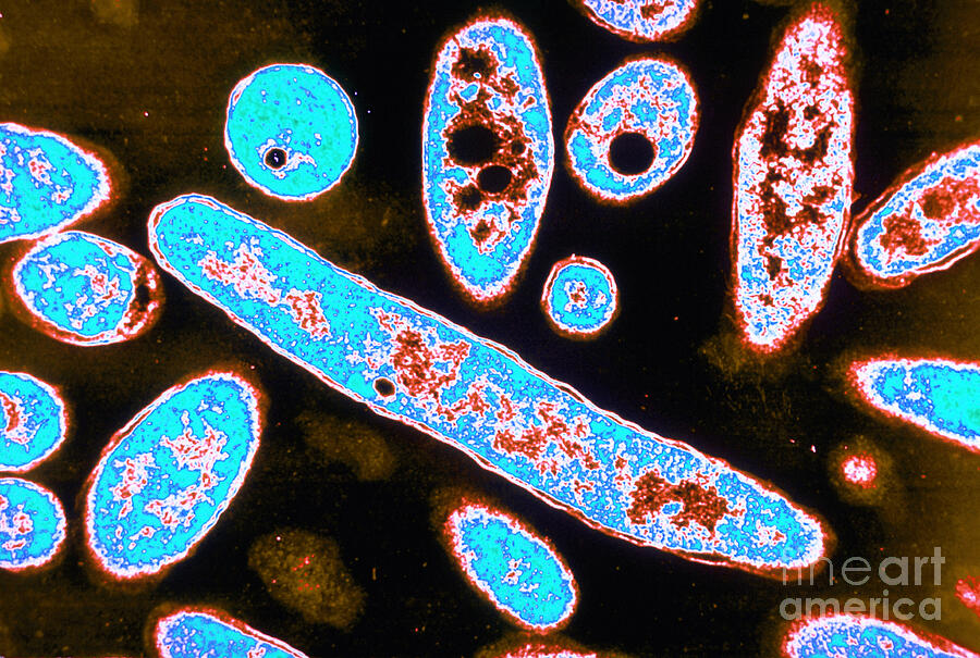 Legionella Pneumophila Bacteria, Cause of Legionnaire's Disease, Under ...