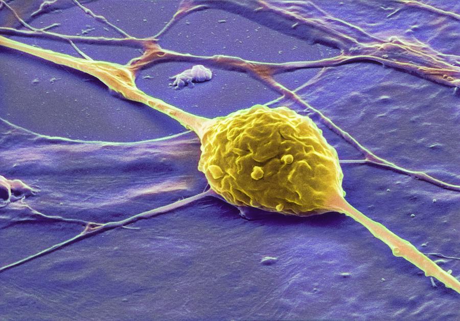 Granule Nerve Cell, Sem #2 by David Mccarthy / Science Photo Library
